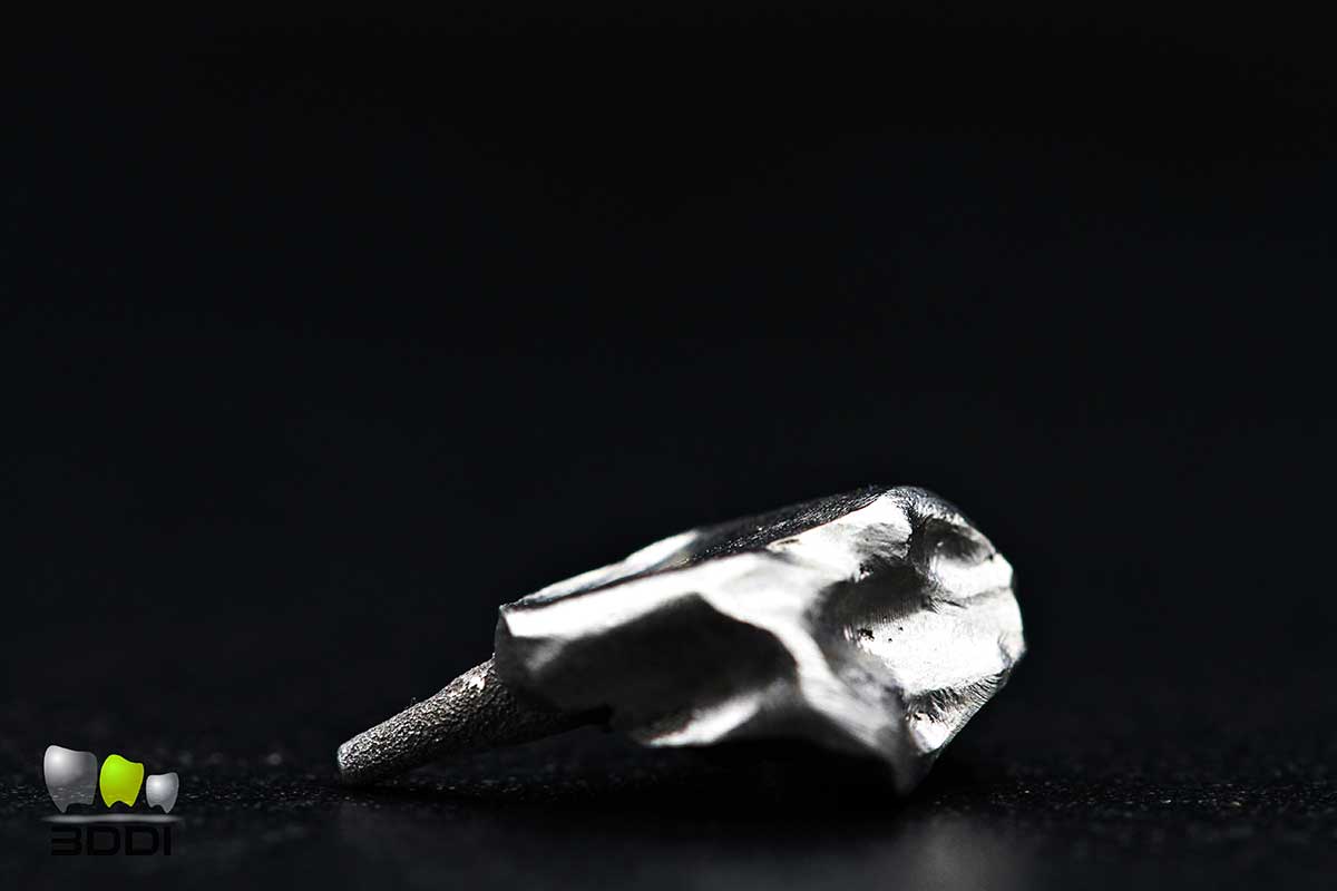 Fabricant de prothèses dentaires Lorient - Laboratoire 3D Dental Impression