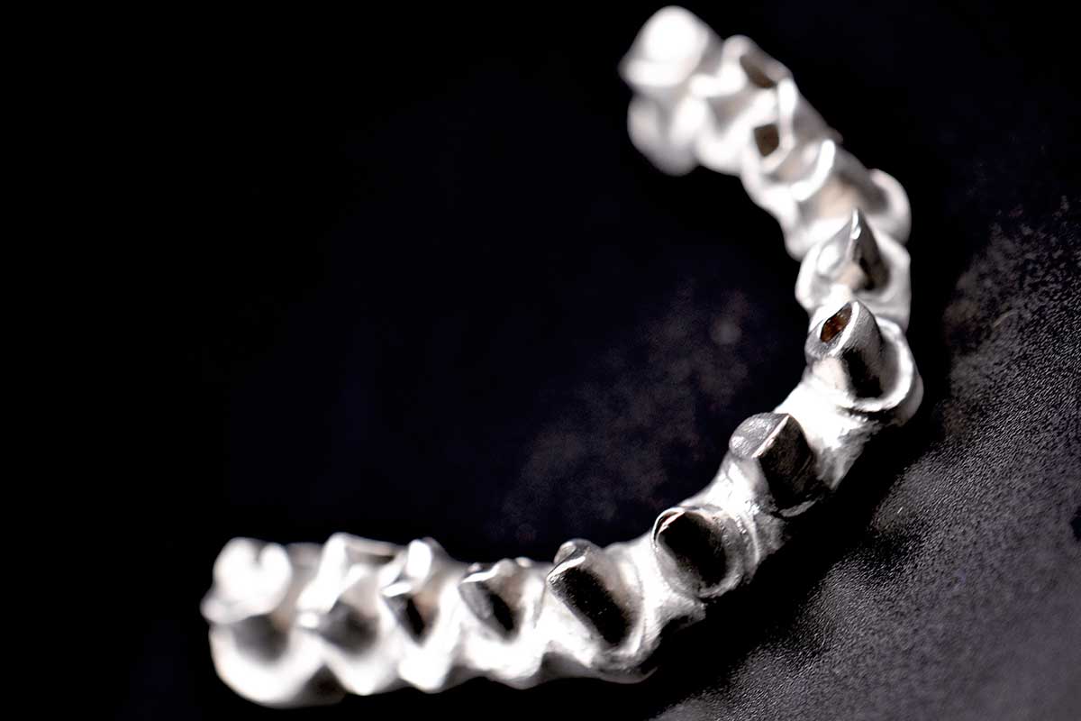 Thimble barre - Laboratoire 3D Dental Impression