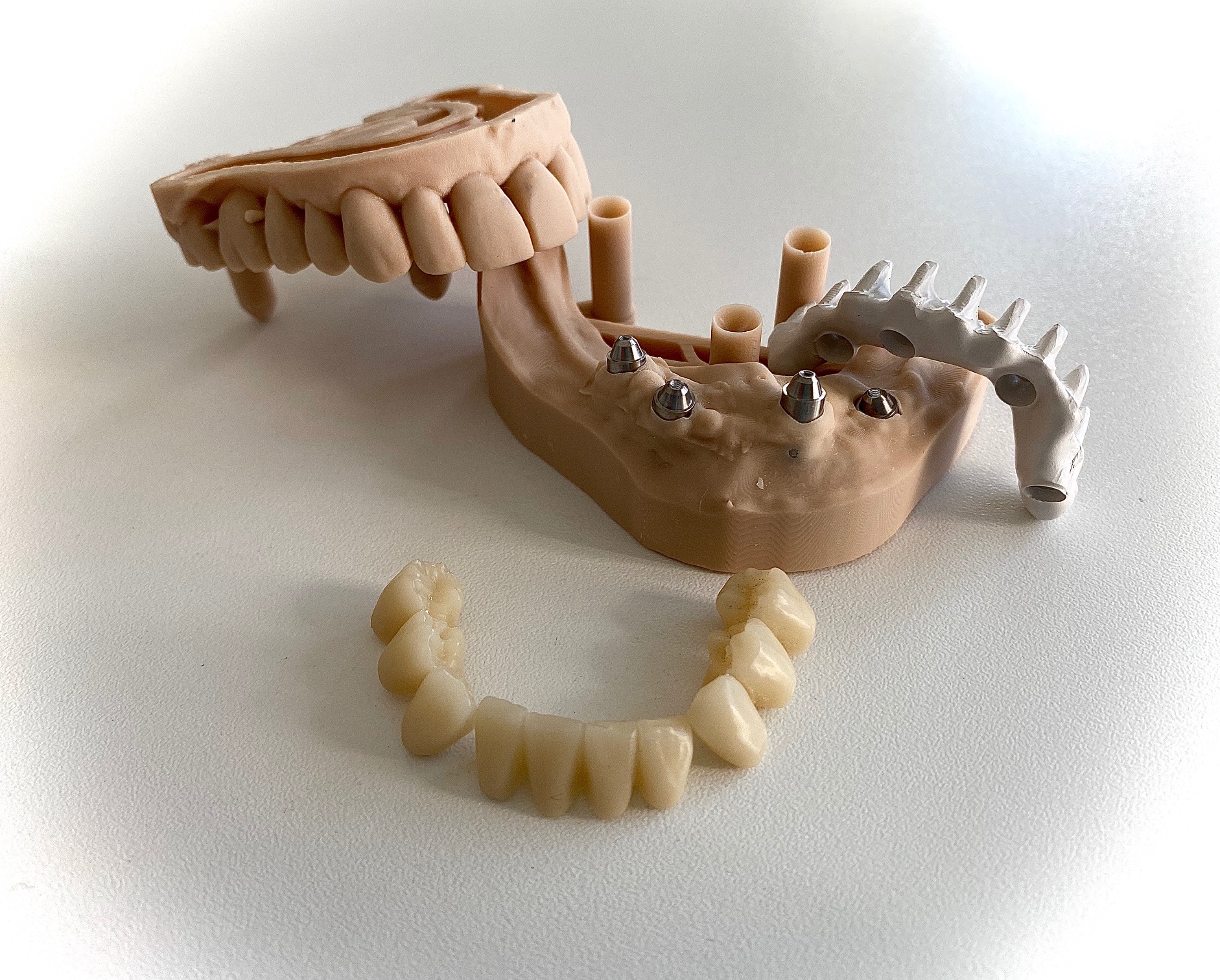Thimble barre - Laboratoire 3D Dental Impression