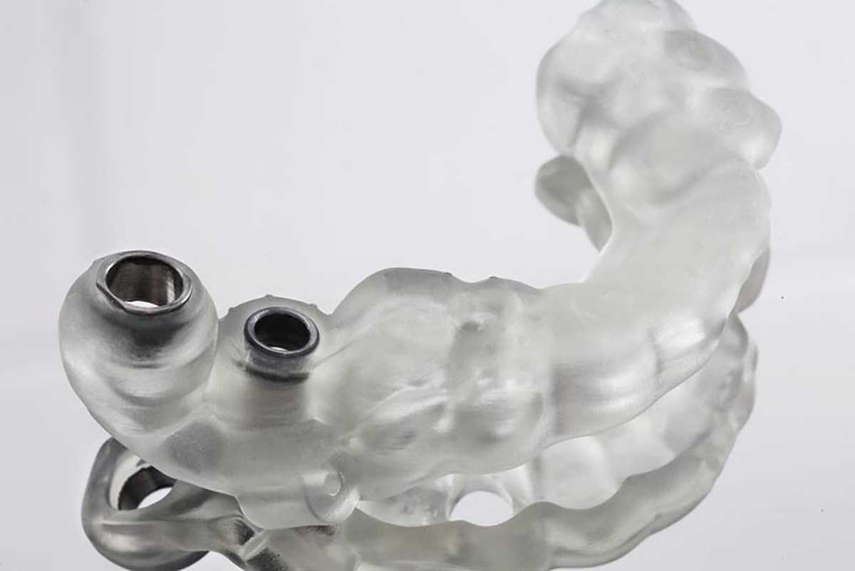 Guide chirugical - Laboratoire 3D Dental Impression