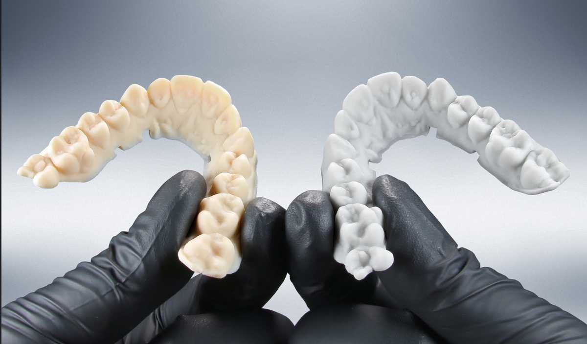 Wax-up numérique - Laboratoire 3D Dental Impression